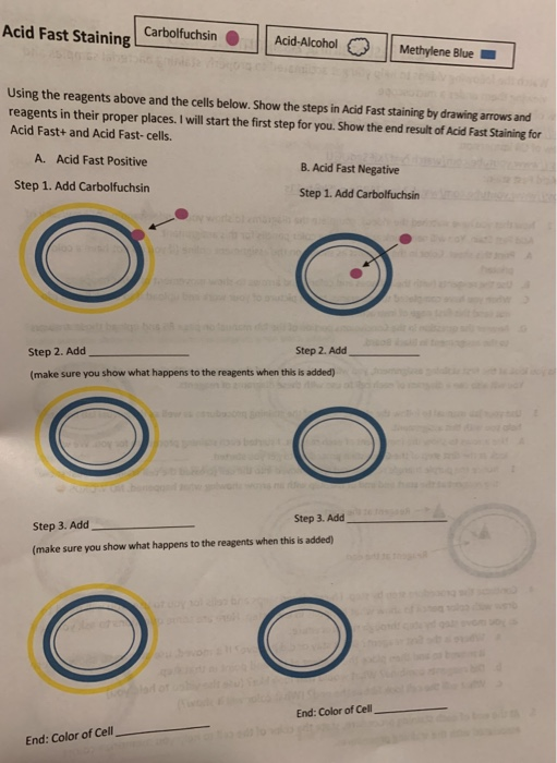 Solved Acid Fast Staining Carbolfuchsin Acid-Alcohol Q | Chegg.com