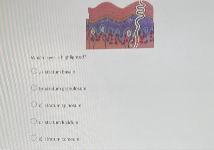Solved Which layer is bighlighted? a) stratum basale b) | Chegg.com