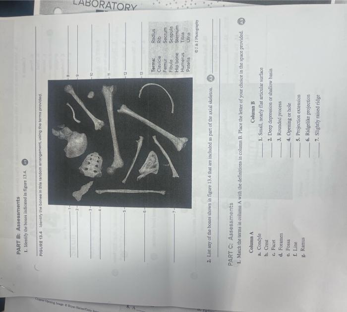 PART B: Assessments 1. Identify the bones indiested | Chegg.com