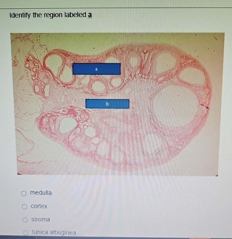 Solved Identify the region labeled amedullacortexstroma | Chegg.com