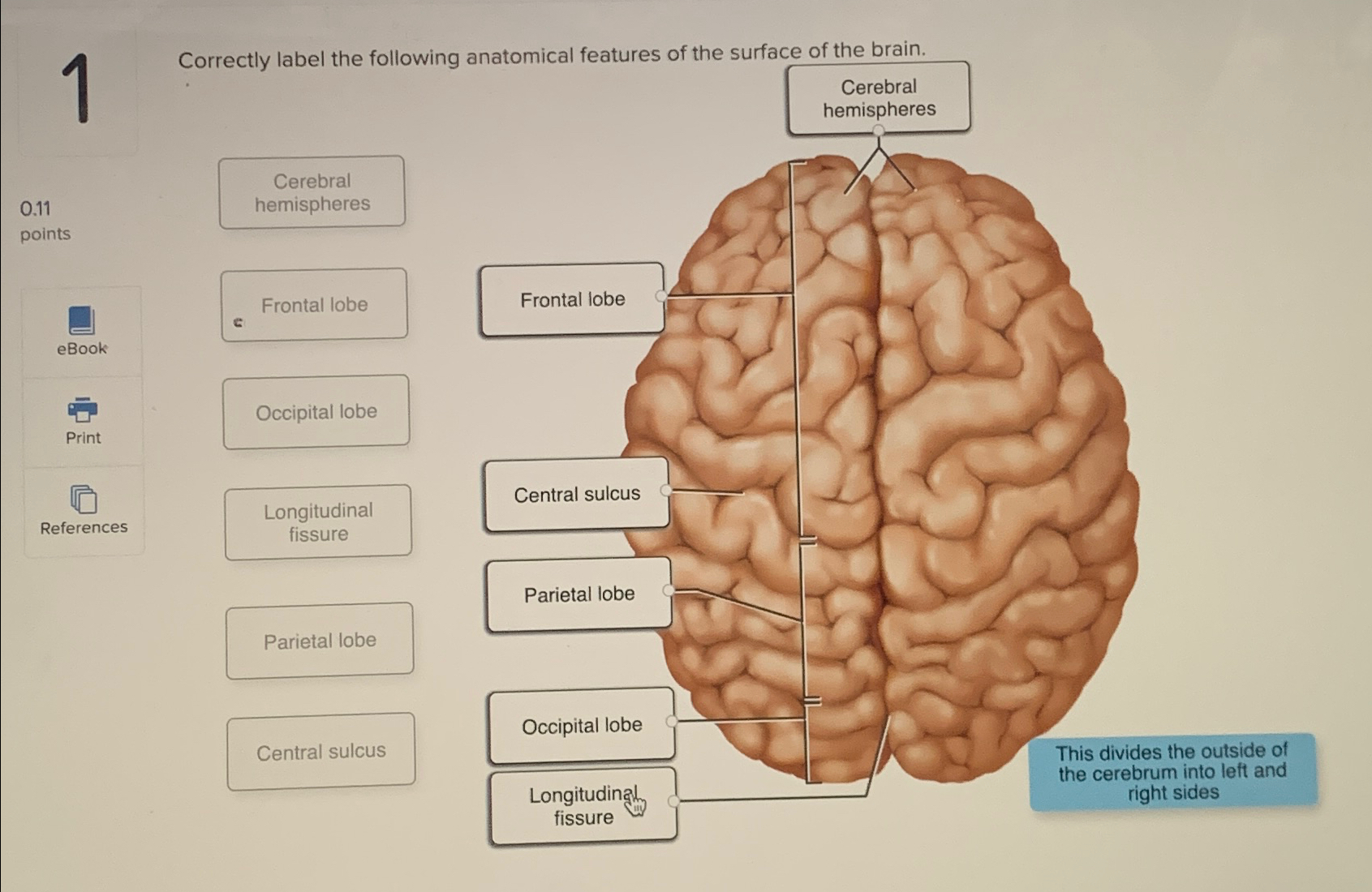 Solved 1Correctly label the following anatomical features of | Chegg.com