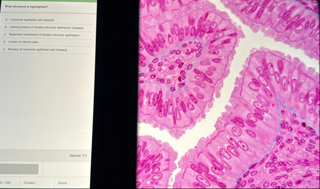 Solved What atructure is highlighted?A. ﻿Columnar epitnetial | Chegg.com