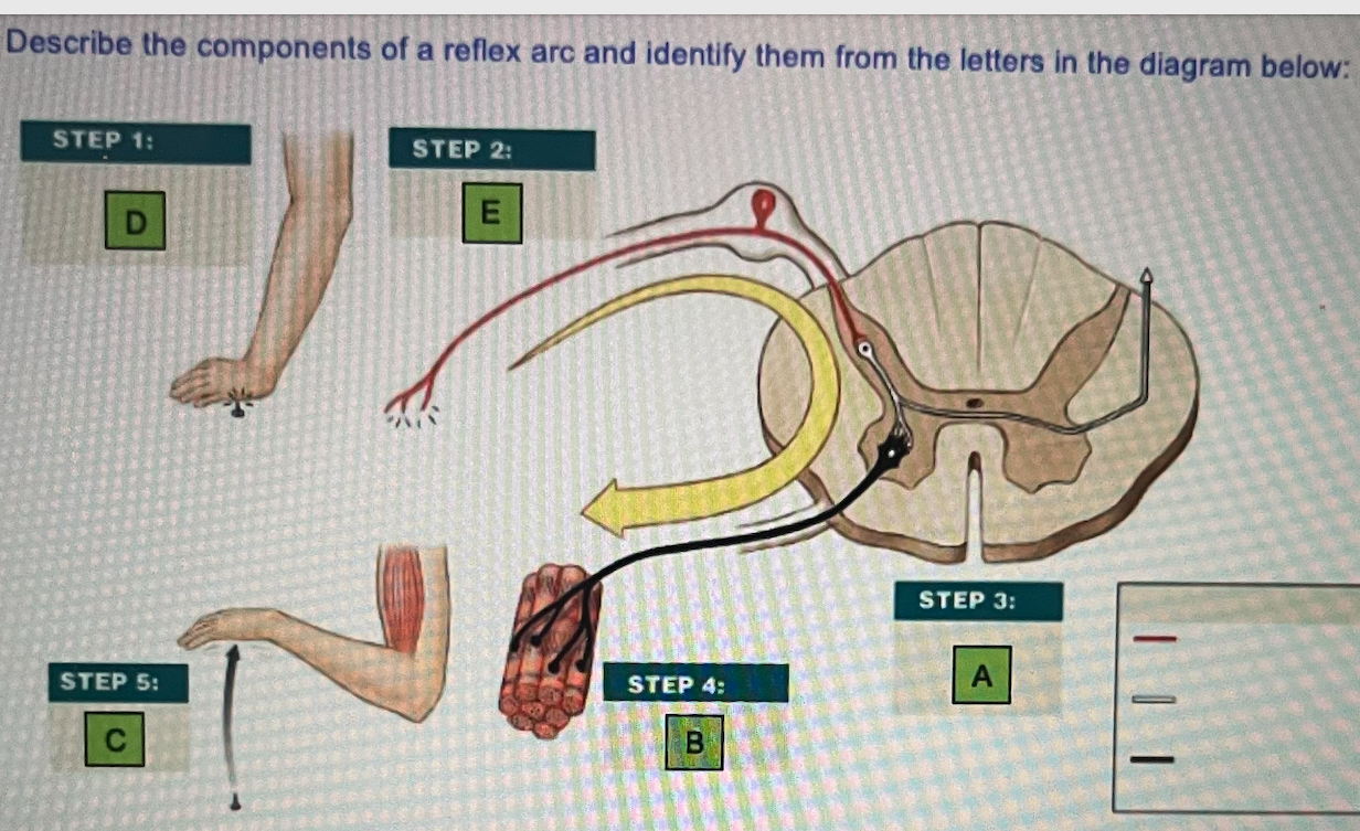 Solved Describe the components of a reflex arc and identify | Chegg.com