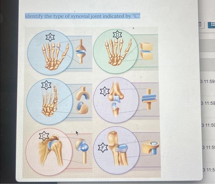 Solved Identify the type of synovial joint indicated by "C." | Chegg.com