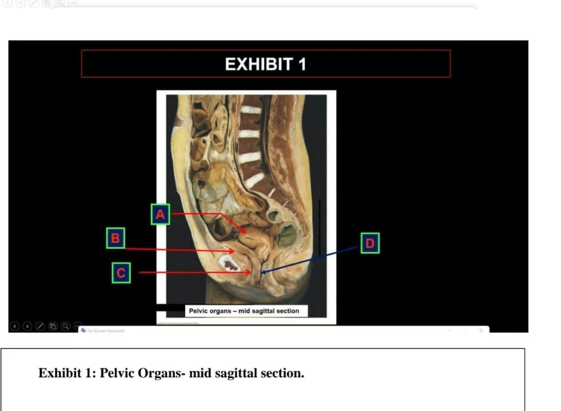 Solved Identify structures A ,B,C,D Name the epithelium | Chegg.com