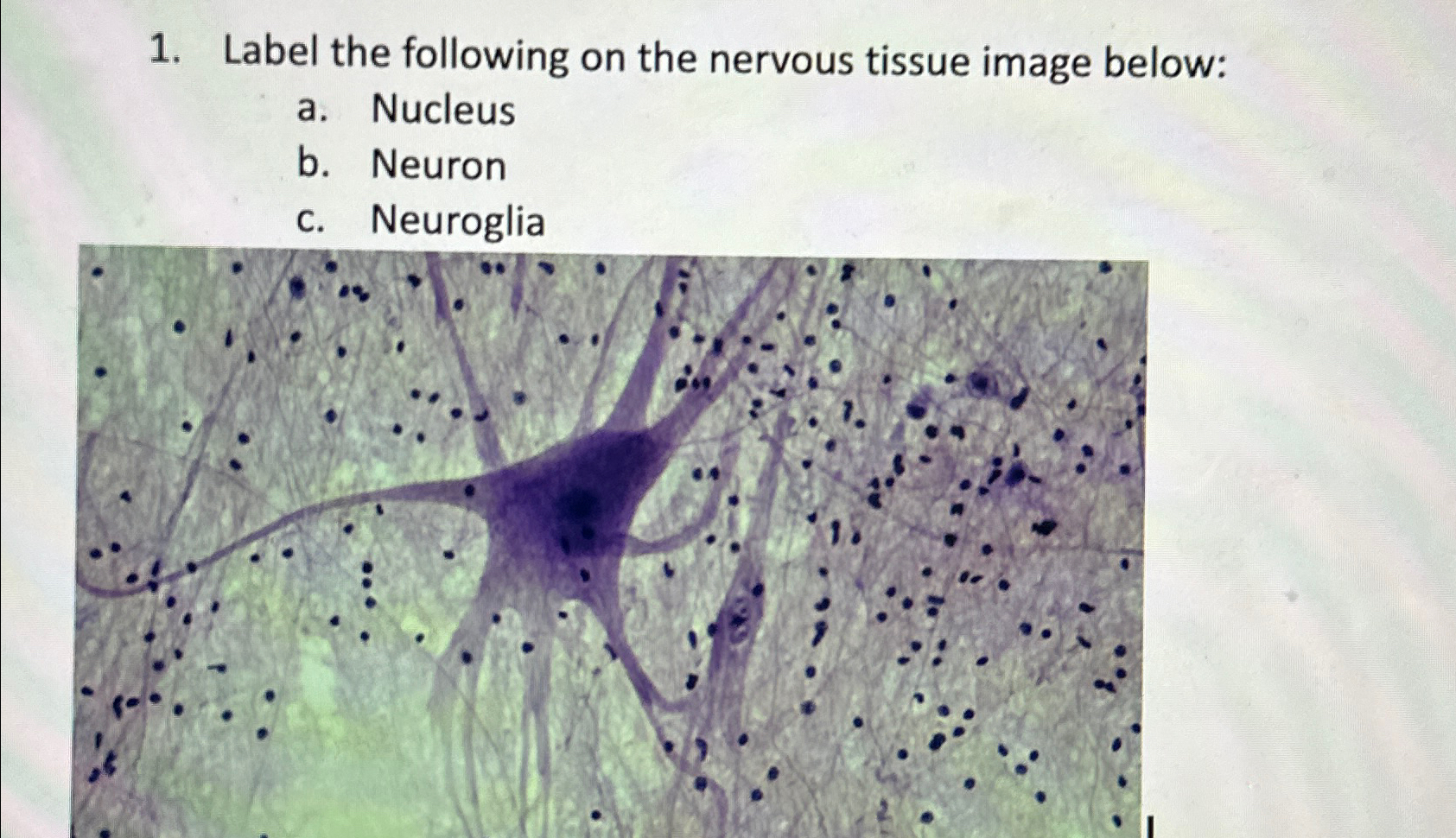 Solved Label the following on the nervous tissue image | Chegg.com