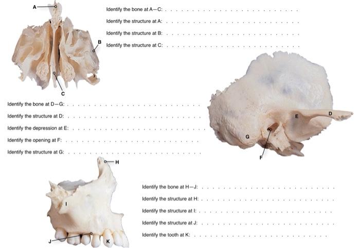 Solved Identity the bone at A-C: Identify the structure at | Chegg.com