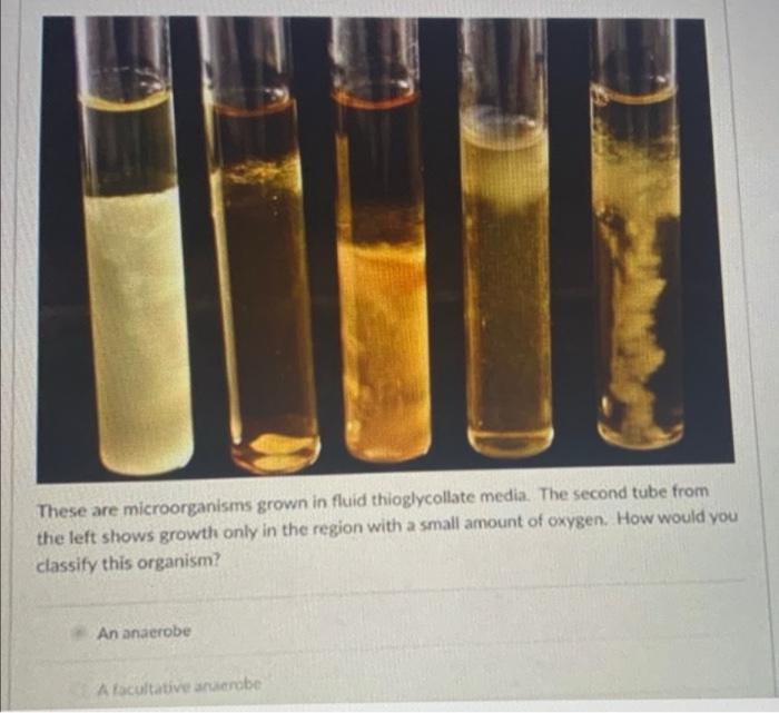 Solved These are microorganisms grown in fluid | Chegg.com