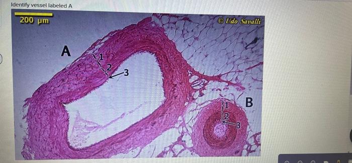 Solved Identify vessel labeled A | Chegg.com