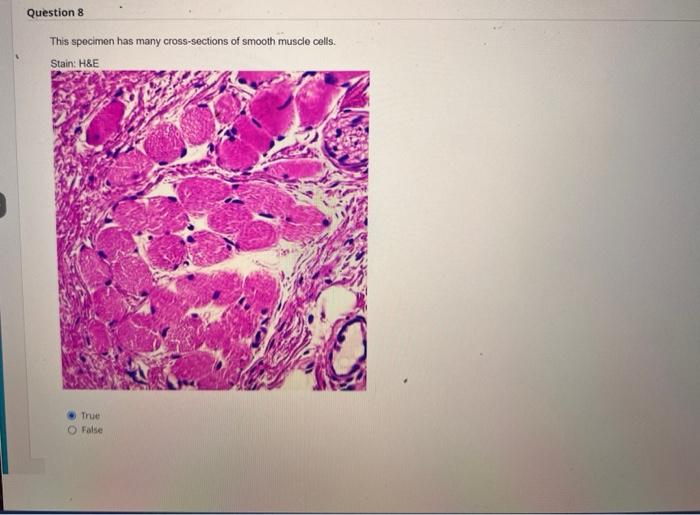 Solved This specimen has many cross-sections of smooth | Chegg.com