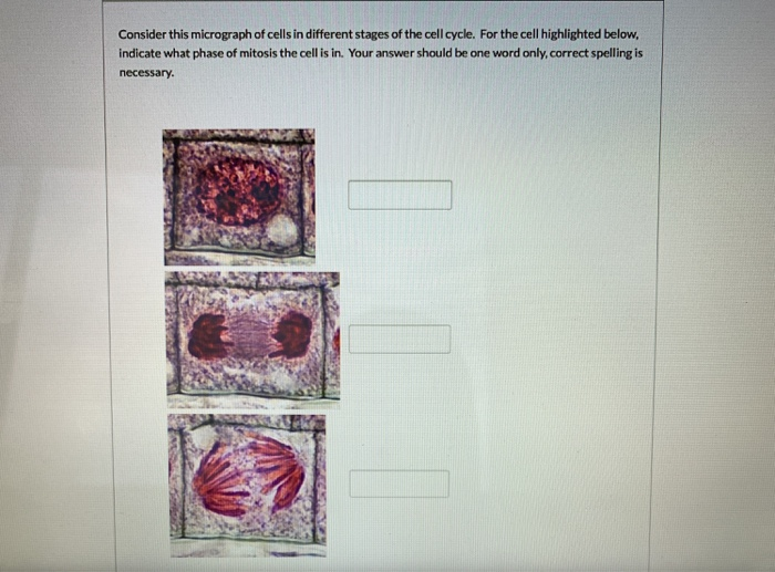 Solved Consider this micrograph of cells in different stages | Chegg.com