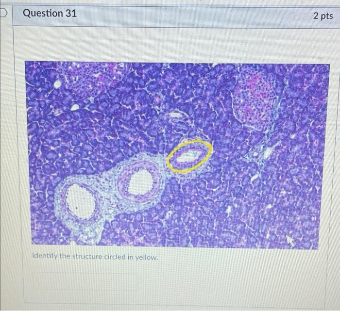 Solved Question 31 2 pts Identify the structure circled in | Chegg.com