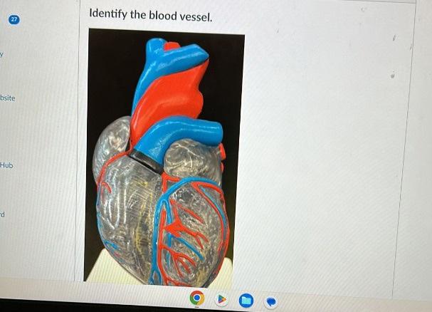 Solved Identify the blood vessel. | Chegg.com
