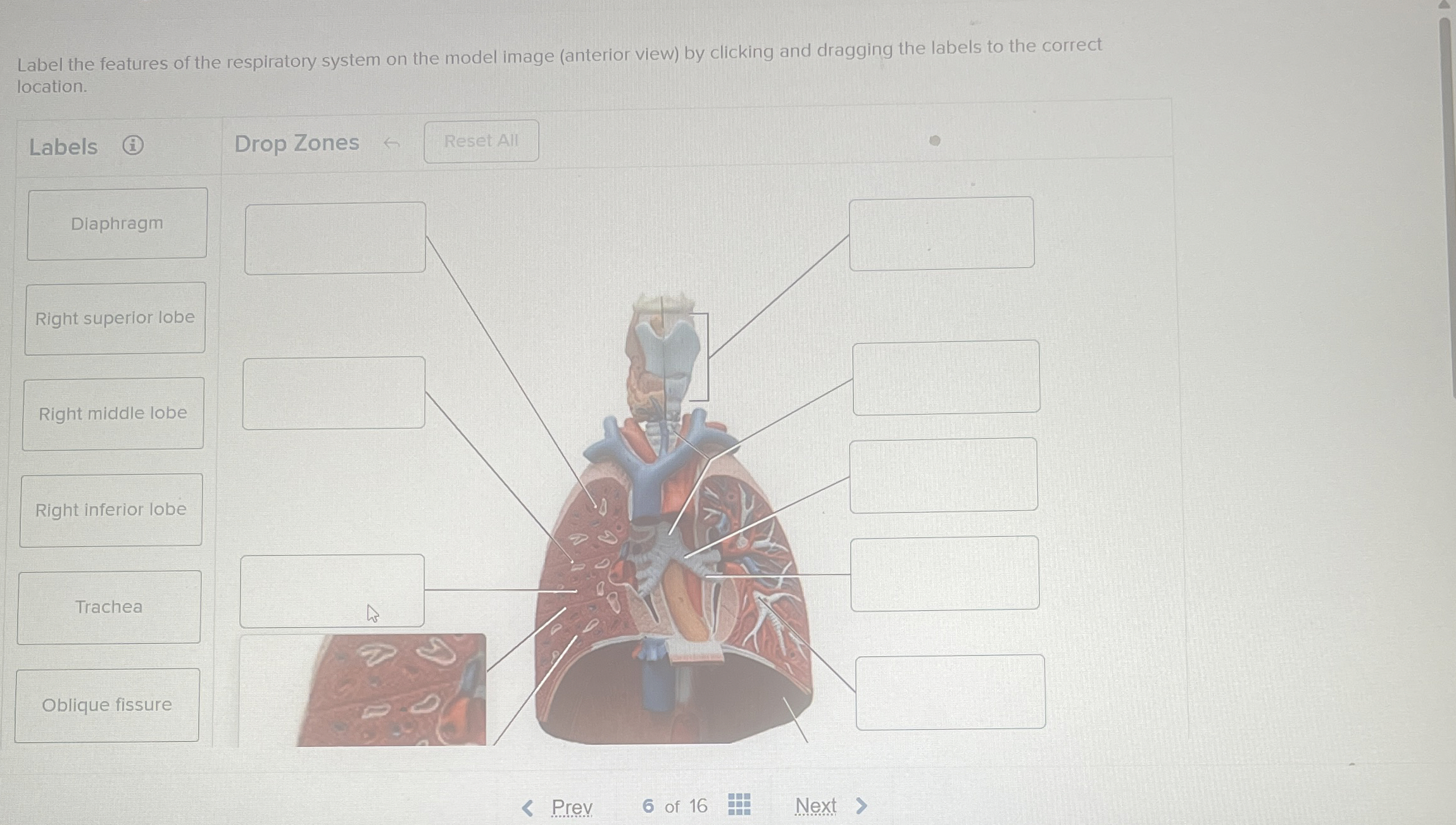 Solved Label the features of the respiratory system on the | Chegg.com