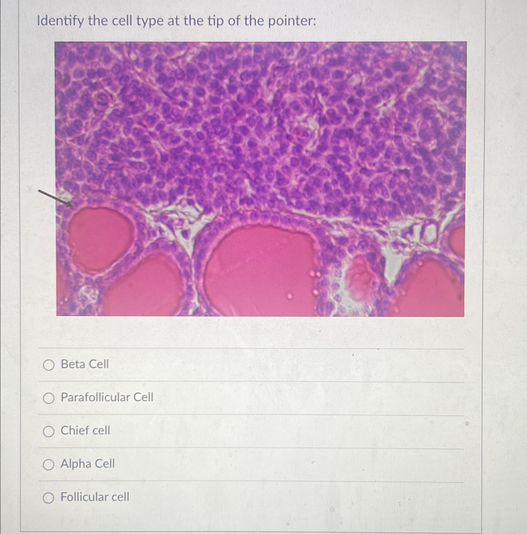 Solved Identify the cell type at the tip of the pointer:Beta | Chegg.com