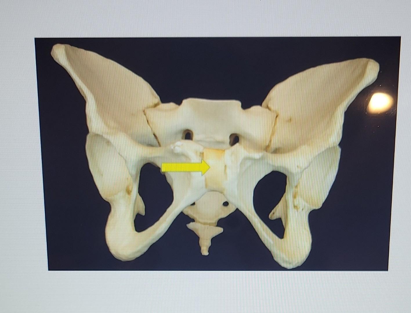 Solved Identify the bone marker indicated by the red | Chegg.com