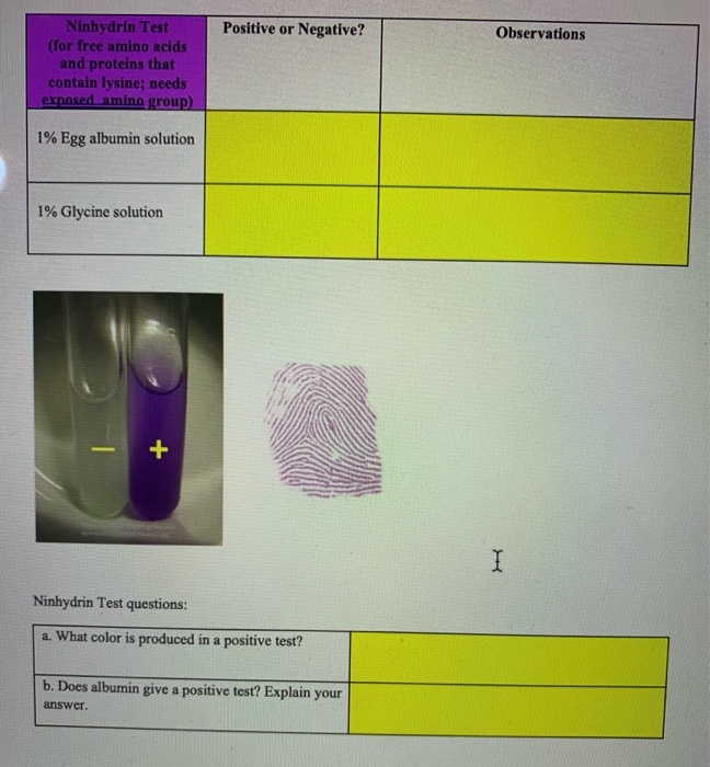 Solved Positive or Negative? Observations Ninhydrin Test | Chegg.com