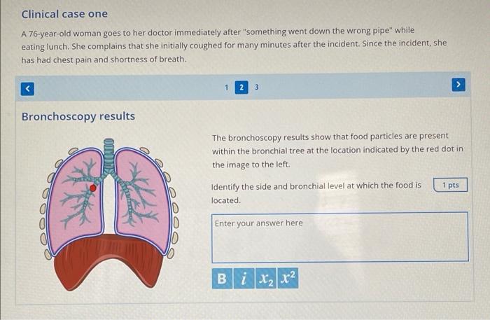 Solved External lungs of sheep (left) and human (right). 1 | Chegg.com