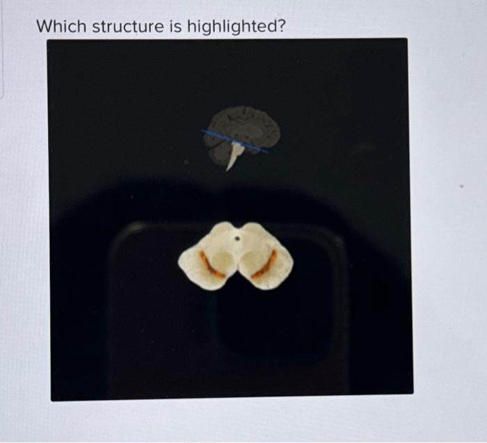 Solved Which structure is hiahliahted? Multiple Choice | Chegg.com