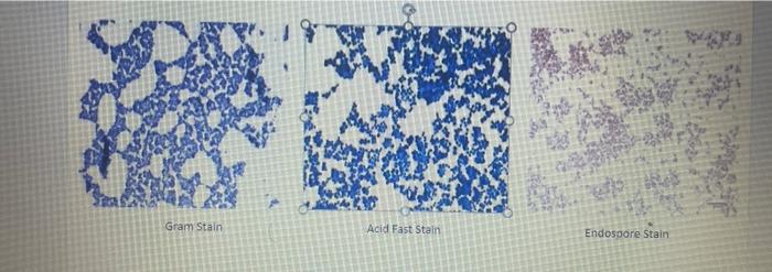 Solved Remember to Use Proper Microbiological Terminology | Chegg.com