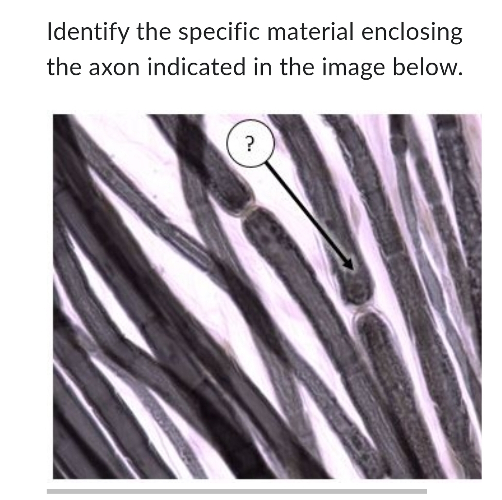 Solved Identify the specific material enclosing the axon | Chegg.com
