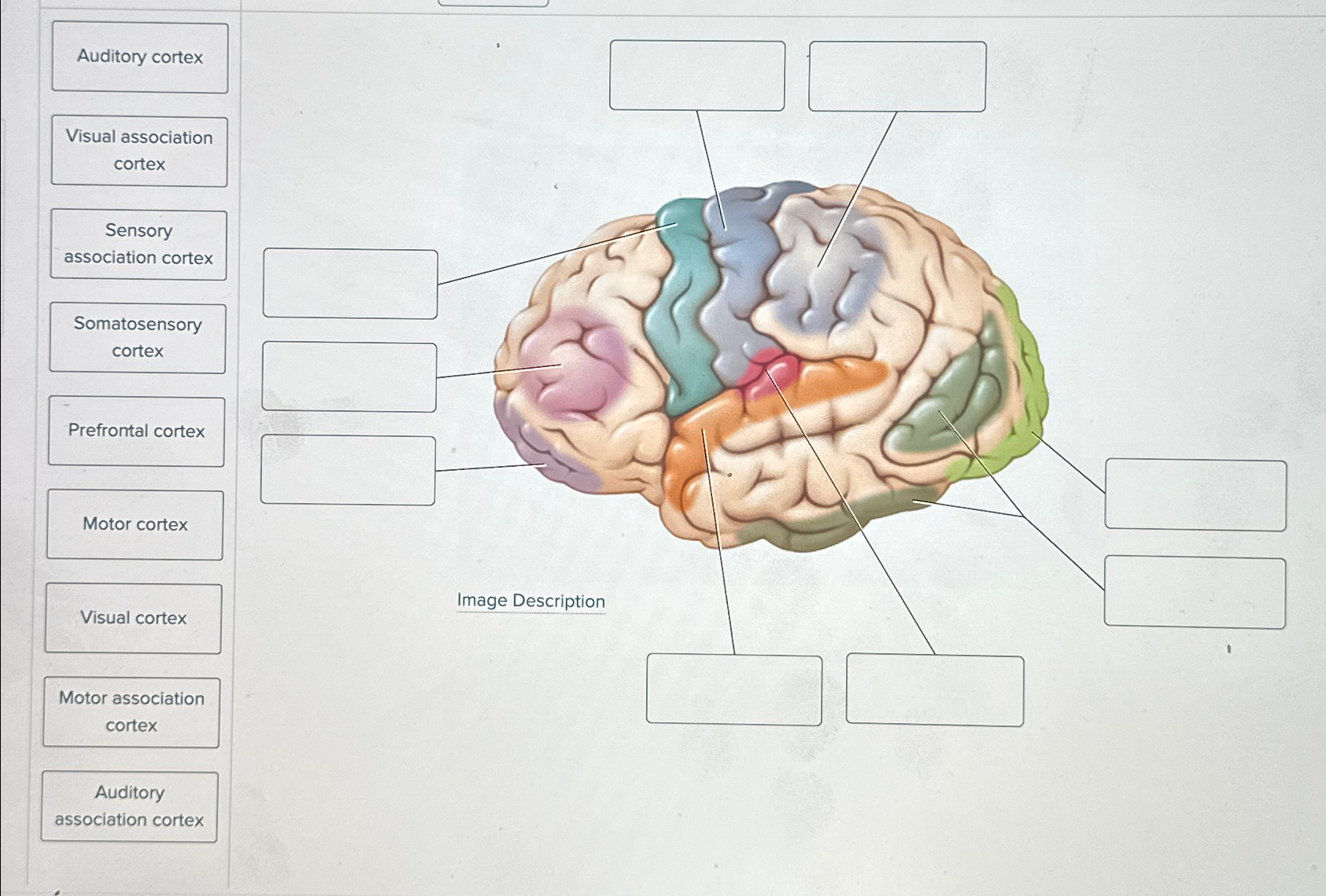 Solved Labele the brains cortex | Chegg.com