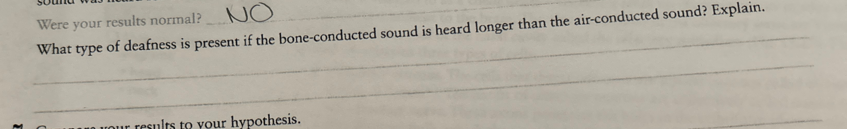 Solved What type of deafness is present if the | Chegg.com