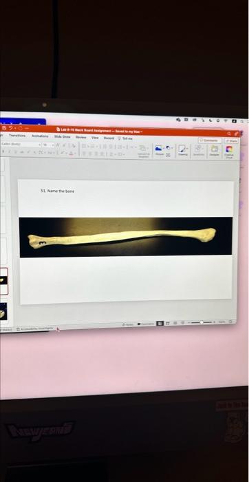 Solved name the bone | Chegg.com