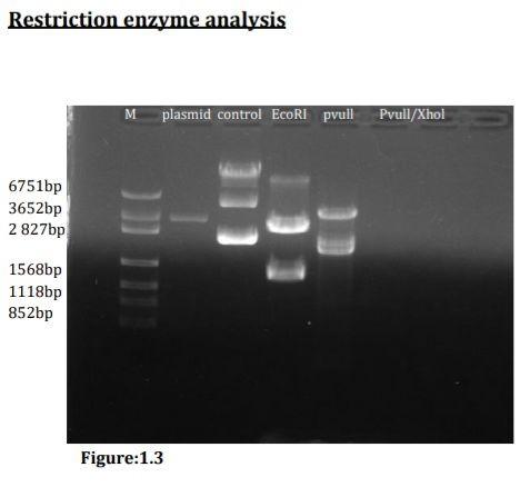 Solved Restriction enzyme analysis | Chegg.com