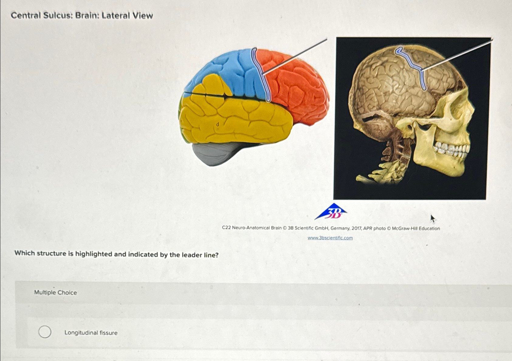 Solved Central Sulcus: Brain: Lateral ViewWhich structure is | Chegg.com