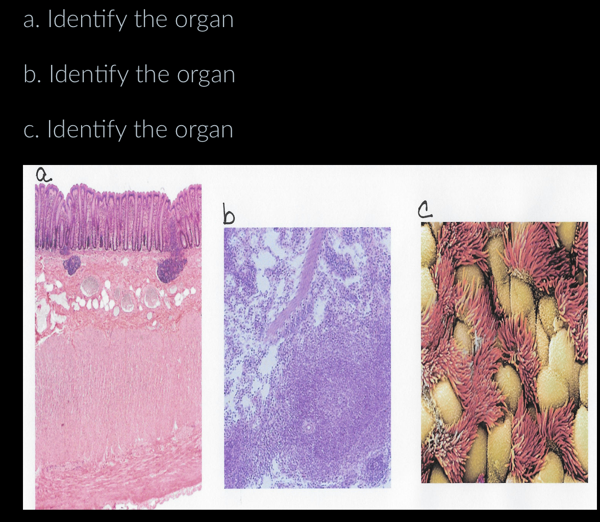 Solved a. ﻿Identify the organb. ﻿Identify the organc. | Chegg.com
