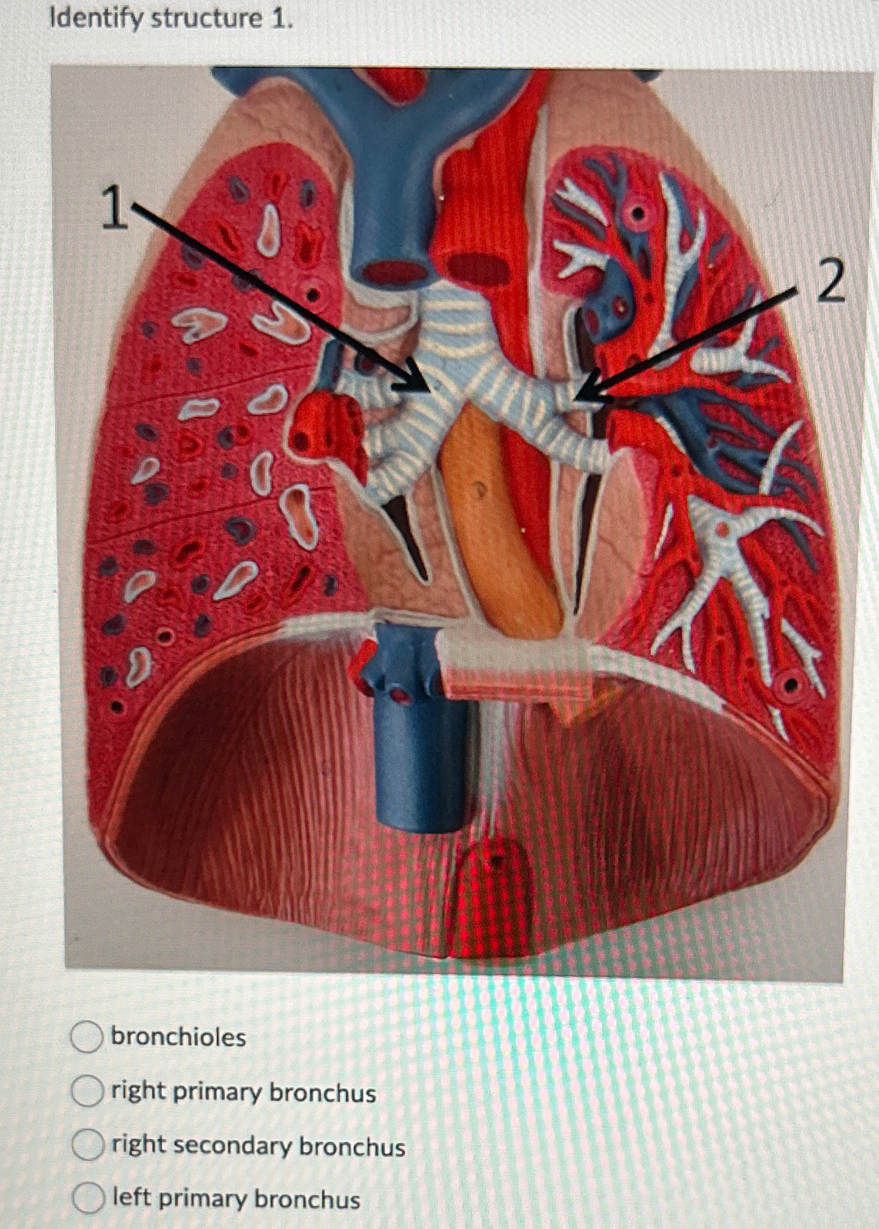 Solved Identify structure 1. ﻿bronchiolesright primary | Chegg.com