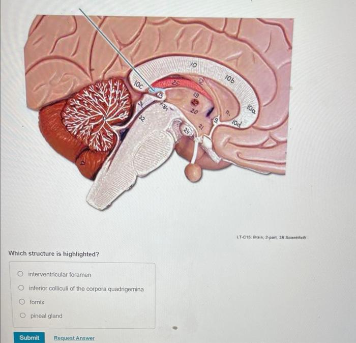 Solved Which structure is highlighted? interventricular | Chegg.com