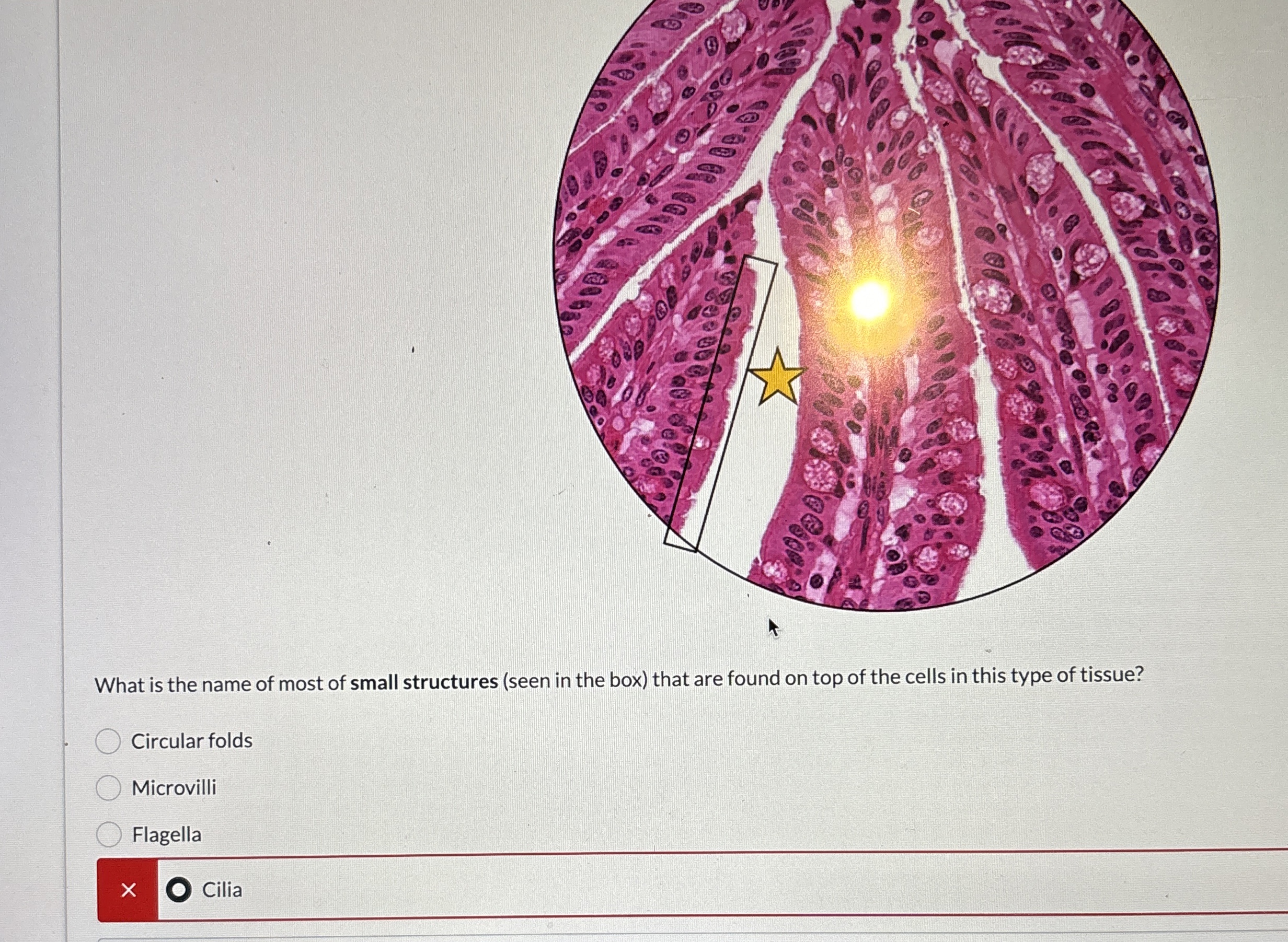 Solved What is the name of most of small structures (seen in | Chegg.com