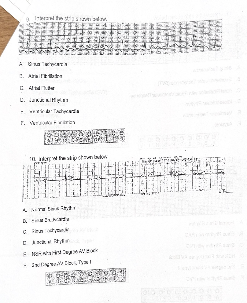 Solved 9. ﻿Interpret the strip shown below. A. ﻿Sinus | Chegg.com