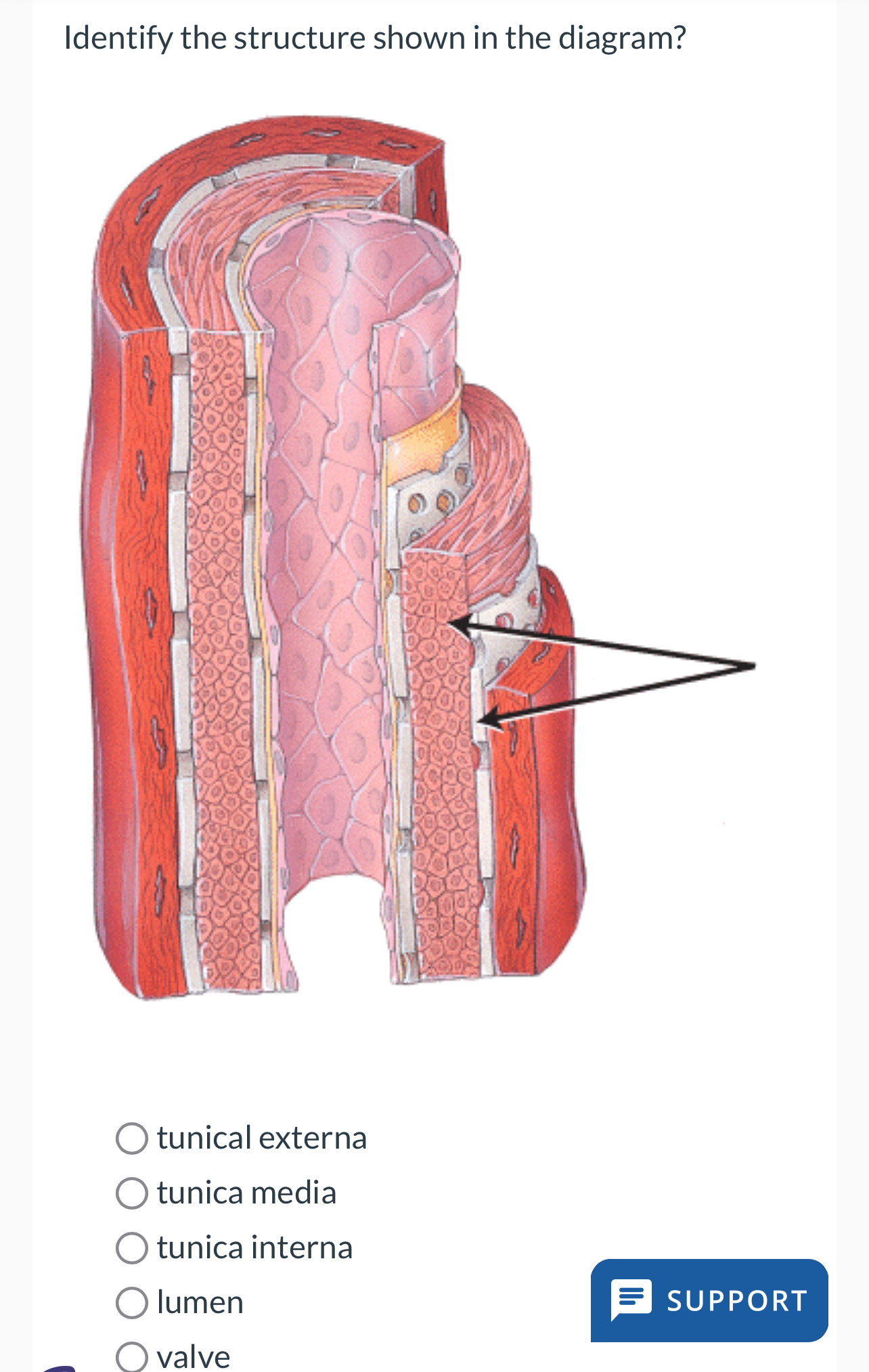 Solved Identify the structure shown in the diagram?tunical | Chegg.com