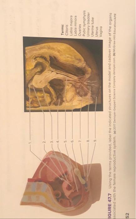 Solved IGURE 47.7 Using the terms provided, label the | Chegg.com