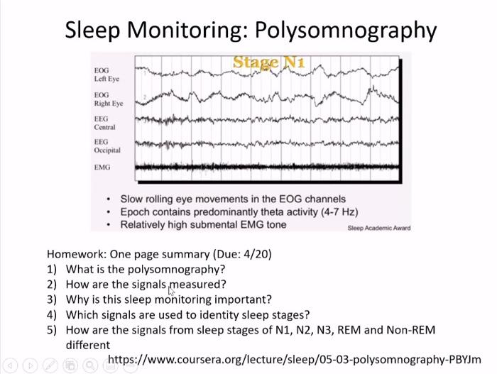 Sleep Monitoring: Polysomnography mm Stage Ni EOG | Chegg.com