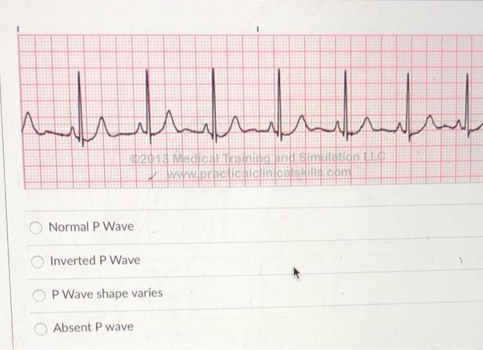 Solved 1 الامامما المسال 022018 Medical Banglademula Lidl | Chegg.com