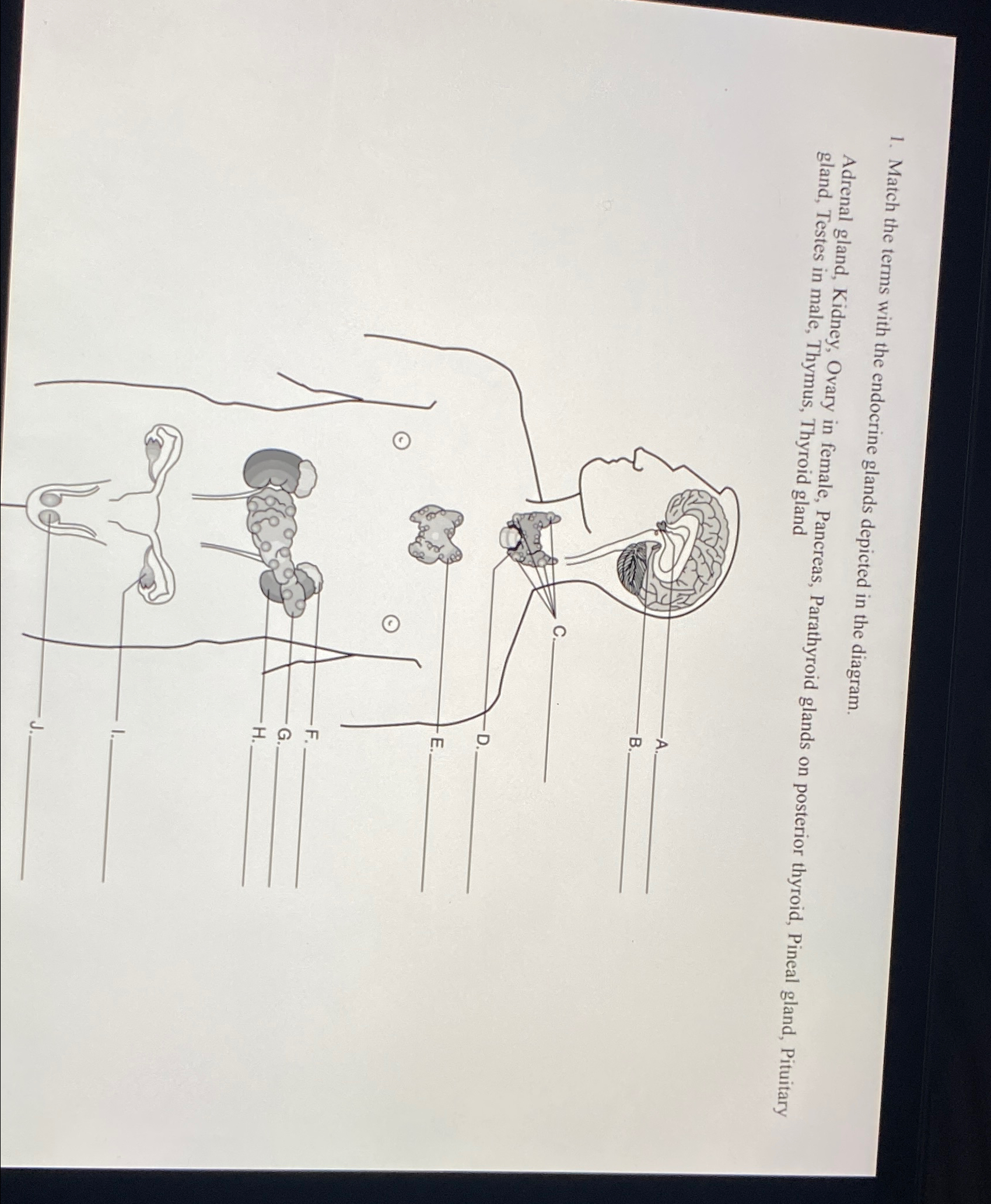 Solved Match the terms with the endocrine glands depicted in | Chegg.com