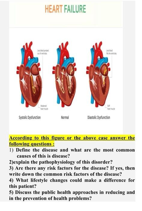 Solved HEART FAILURE 前衝 dhe Systolic dysfunction Normal | Chegg.com