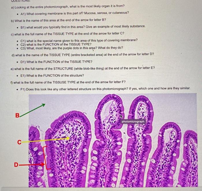 Solved a) Looking at the entire photomicrograph, what is the | Chegg.com