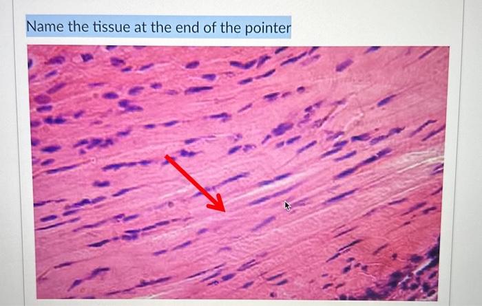 Solved Name the tissue at the end of the pointer | Chegg.com