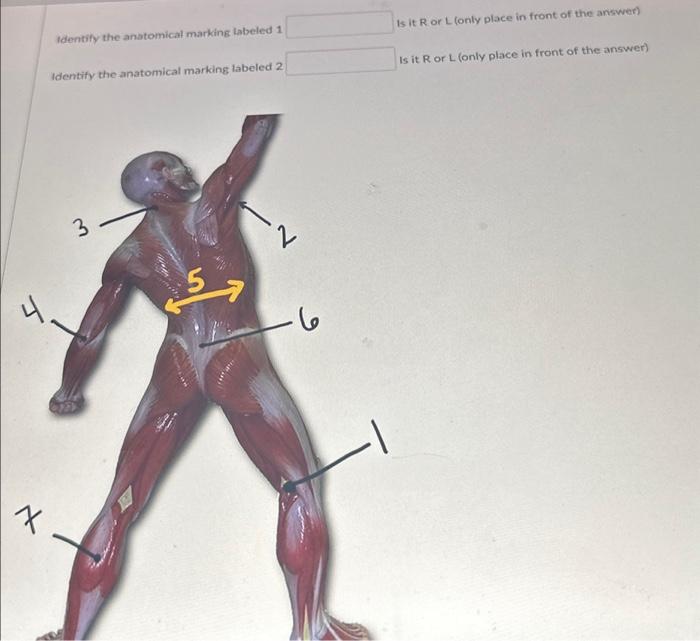 Solved 23. Identify the anatomical marking labeled 1 | Chegg.com