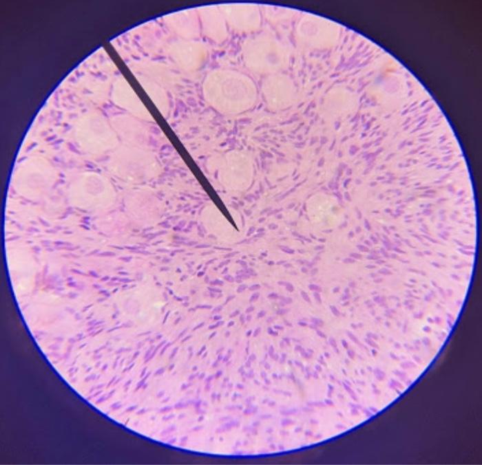 Solved Label Oocyte Nuclei, Follicle, The Antrum, Primary | Chegg.com