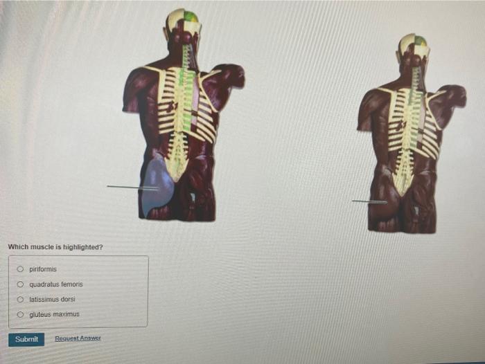 Solved Free Which muscle is highlighted? O piriformis O | Chegg.com