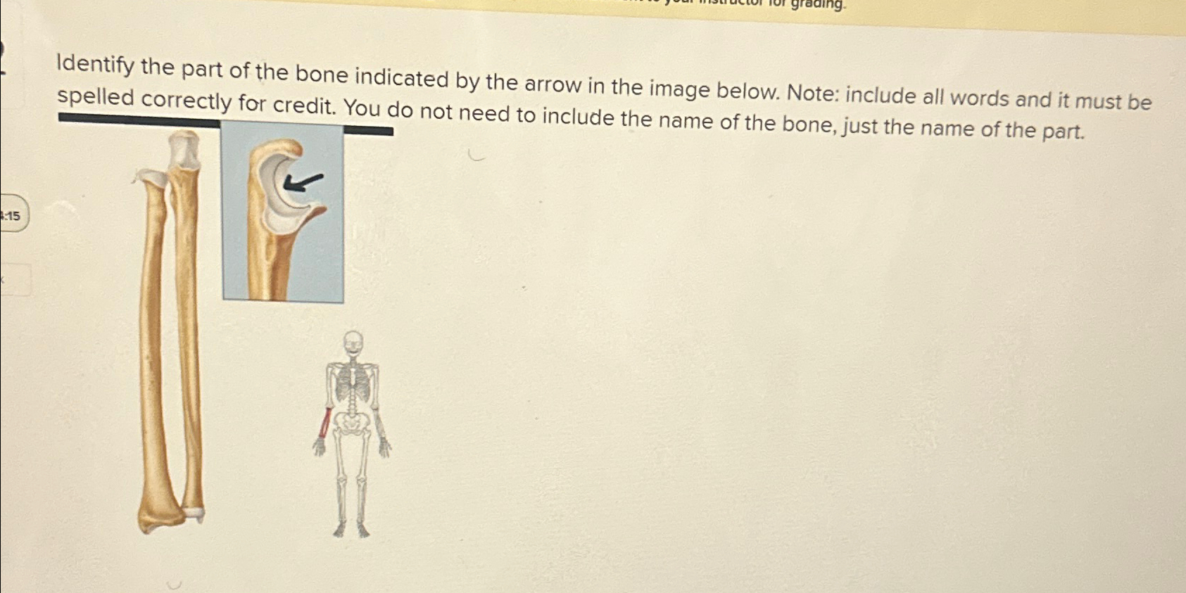 Solved Identify the part of the bone indicated by the arrow | Chegg.com