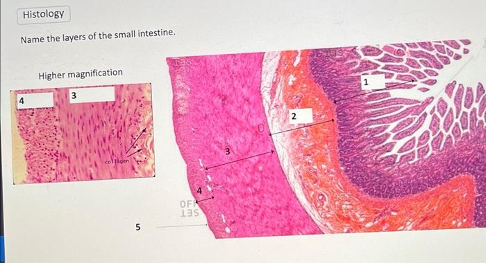 Solved Name the layers of the small intes Higher | Chegg.com