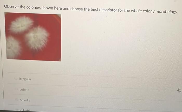 Solved Observe the colonies shown here and choose the best | Chegg.com