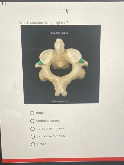 Solved Which structure is highlighted? Axis (Cverter body | Chegg.com